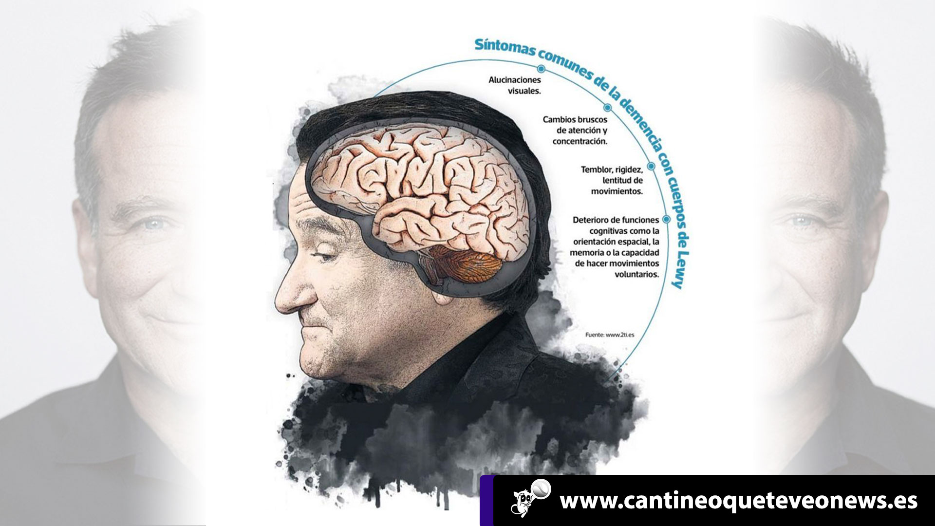 Cuerpos De Lewy La Rara Demencia Que Acab Con Robin Williams Cuerpos De Lewy La Rara Demencia Que Acab Con Robin Williams